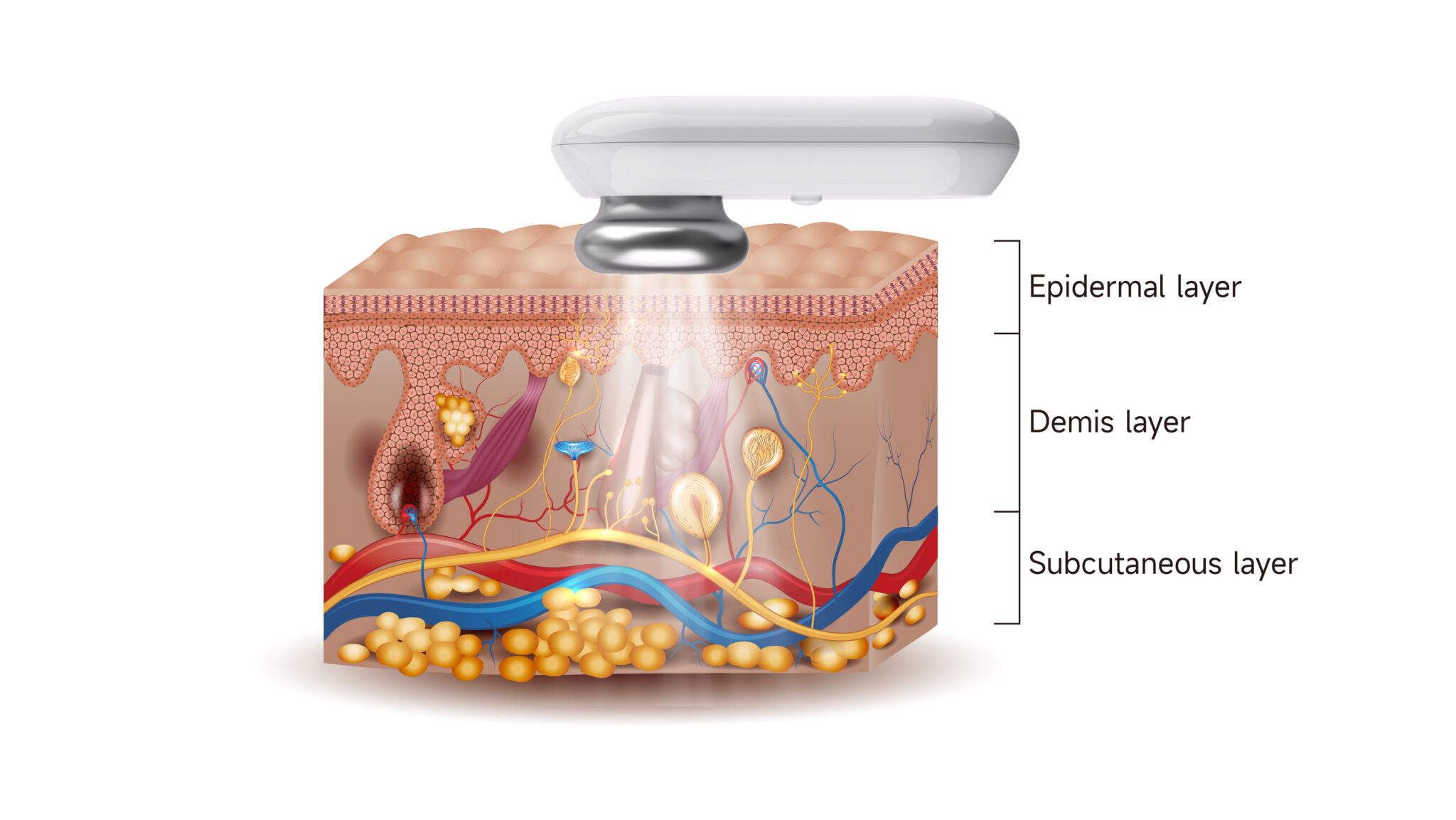 MLAY Radio Frequency Anti-Aging Devices for Skin Tightening